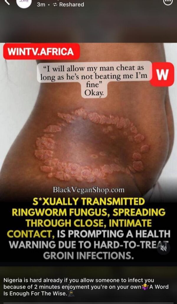 FACT-CHECK: Viral Post Exaggerates Claim About Sexually Transmitted ...